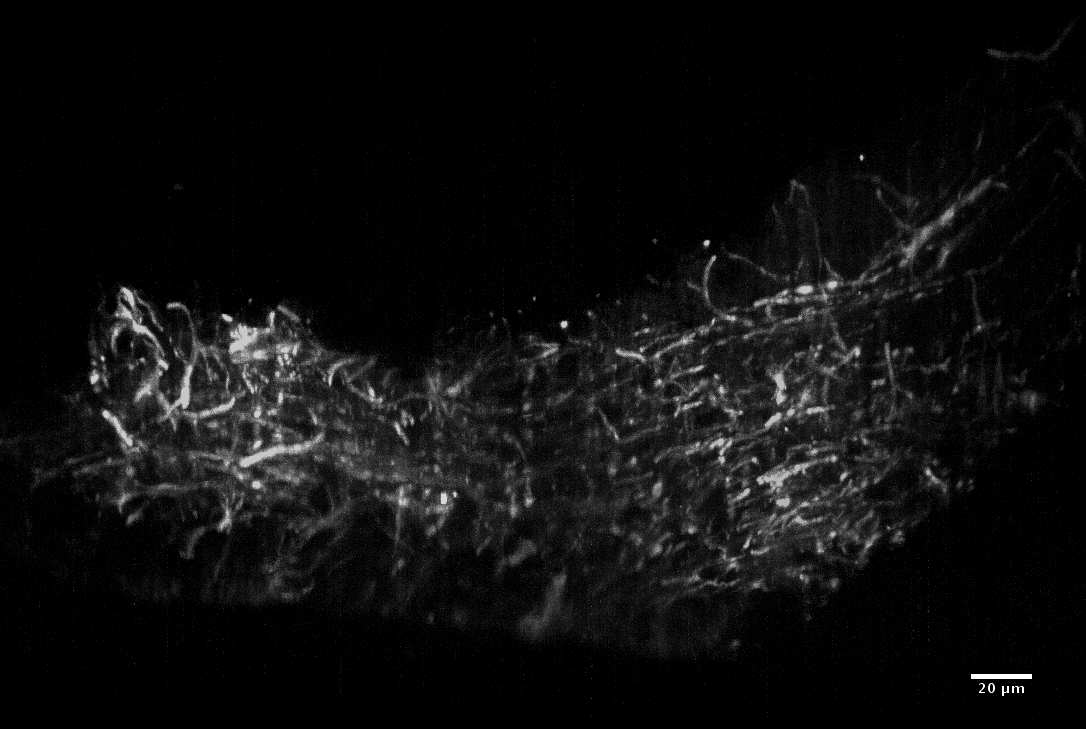 Biophotonic Imaging