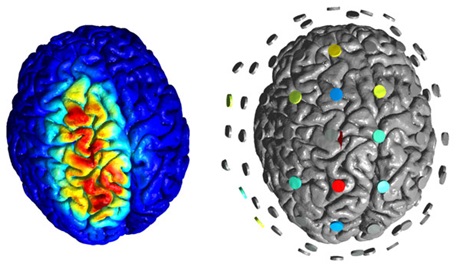 Neurophysics - DTU Health Tech