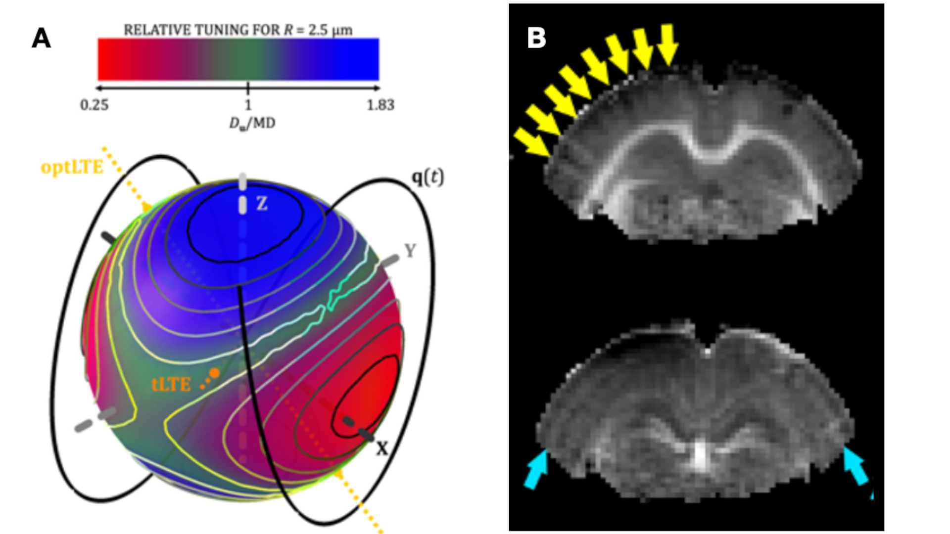 MRI acquisition