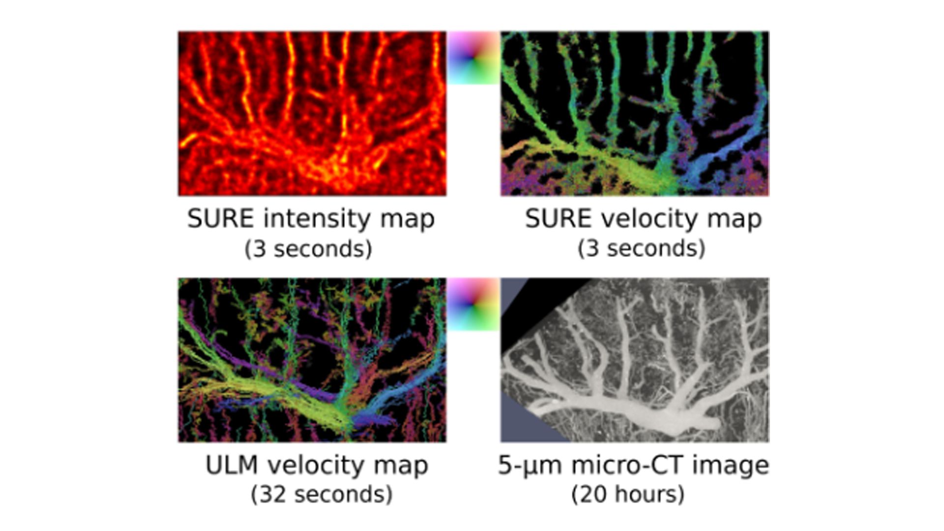 With SURE, we can estimate the microvasculature's flow velocity below ...