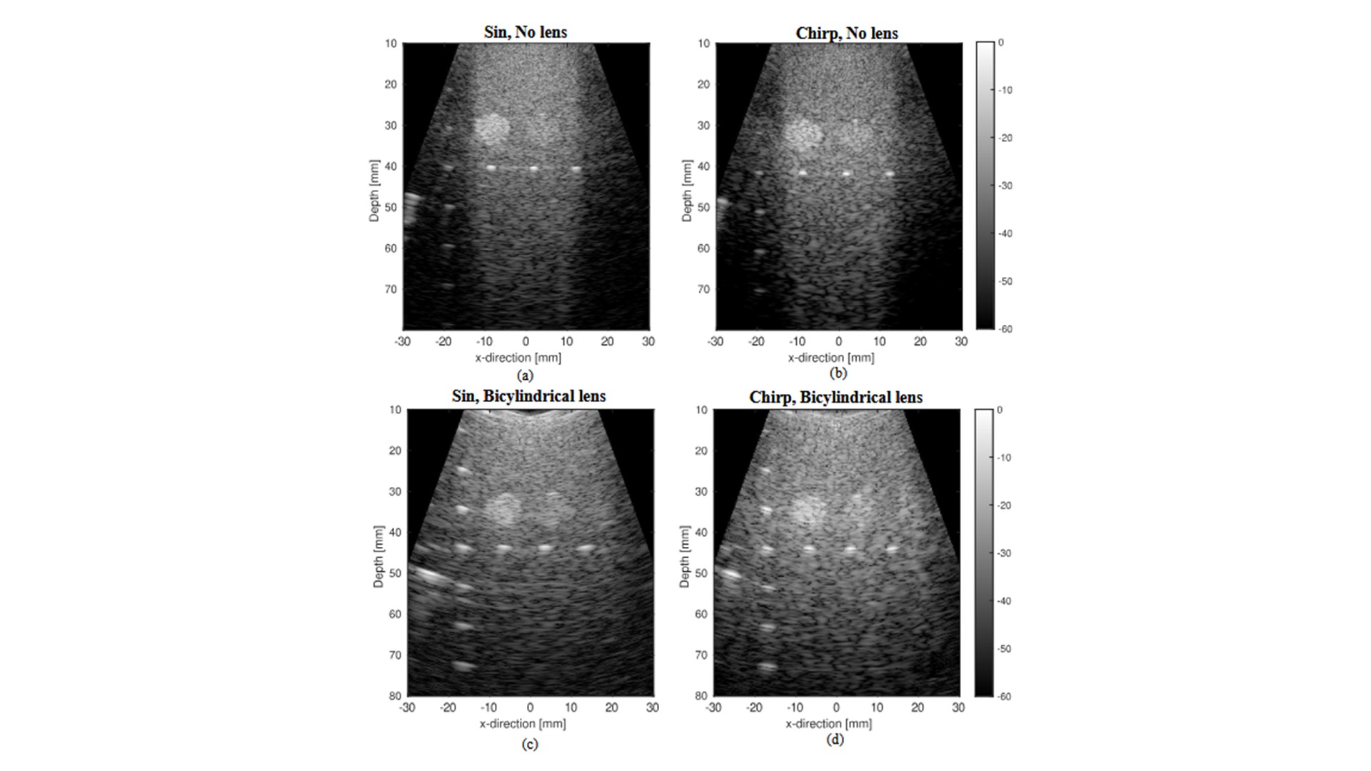 Coded Excitation in 3D Ultrasound Imaging with a Lensed Row-Column Array
