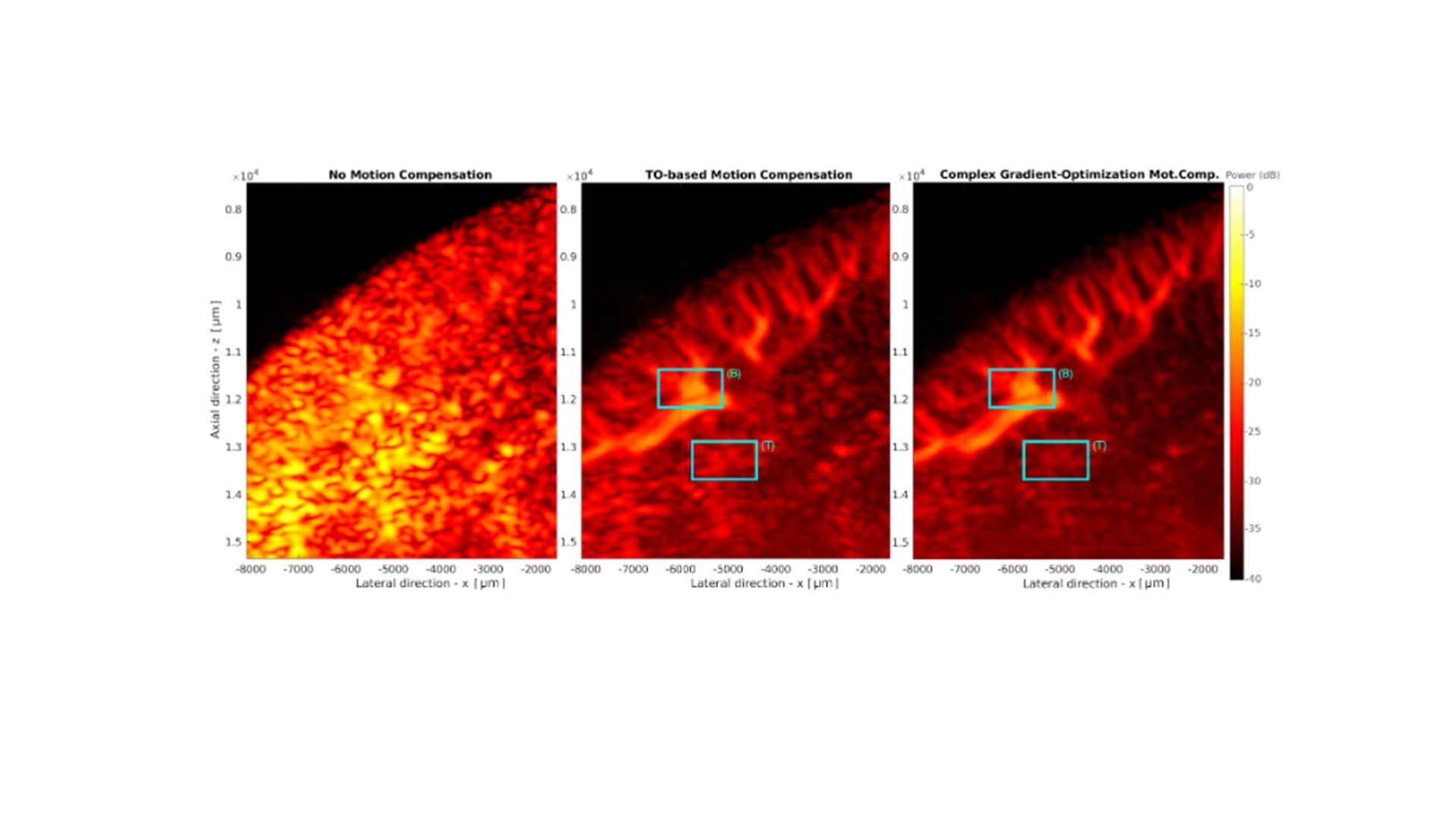 Submicron tissue motion estimation for high framerate ultrasound using ...