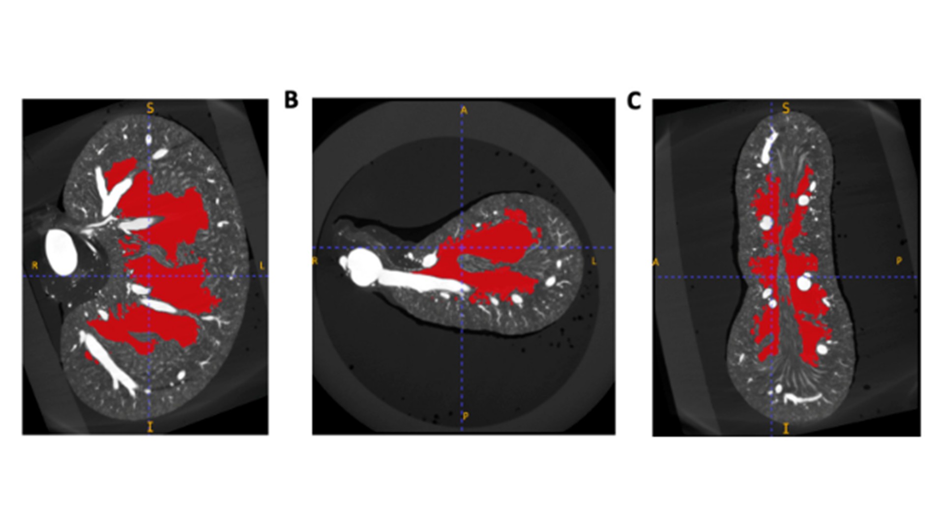 The Zucker Diabetic Fatty Rat as a Model for Vascular Changes in ...