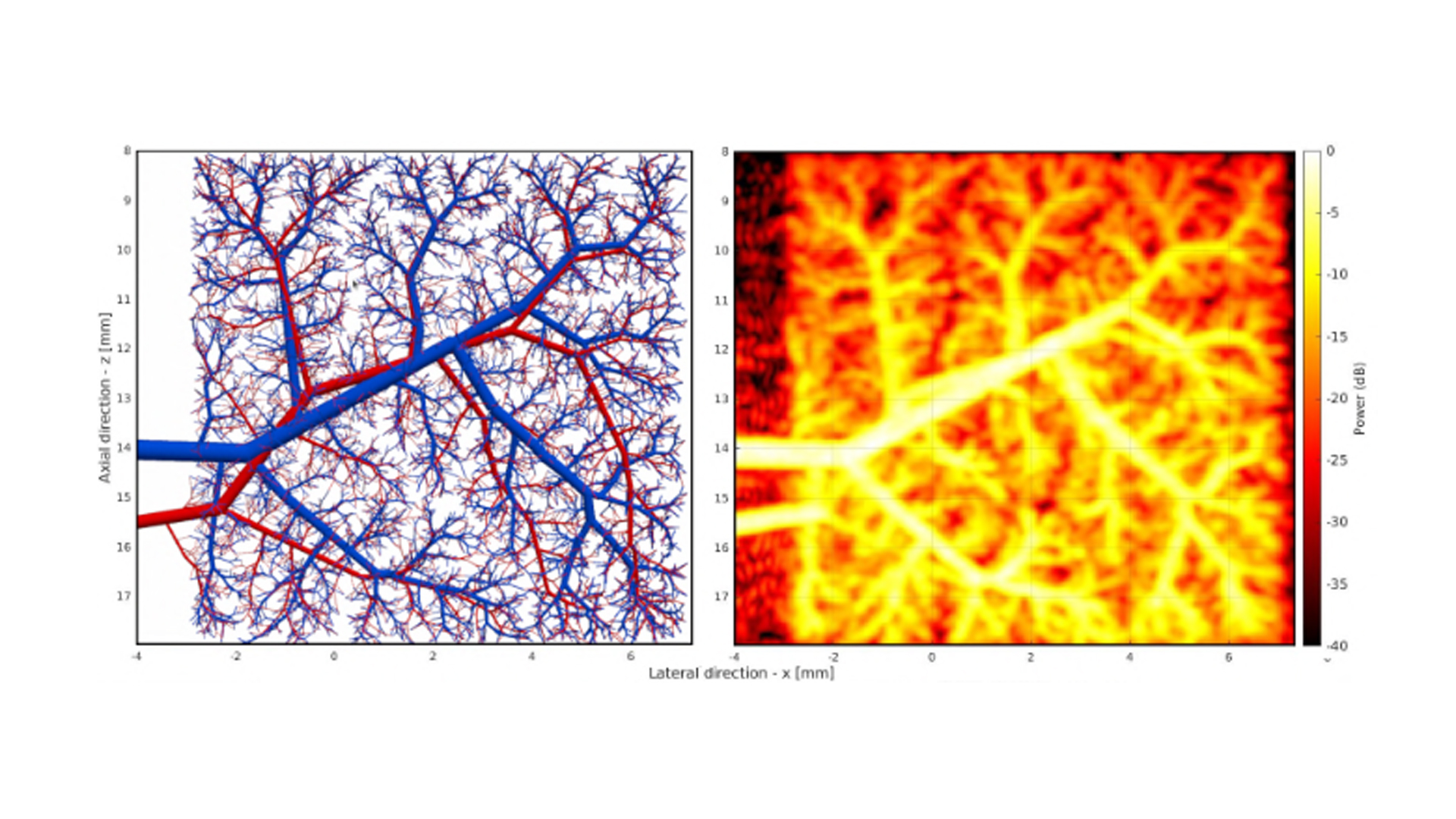 A Graph Based Realistic 3d Microvascular Flow Simulation For Ultrasound