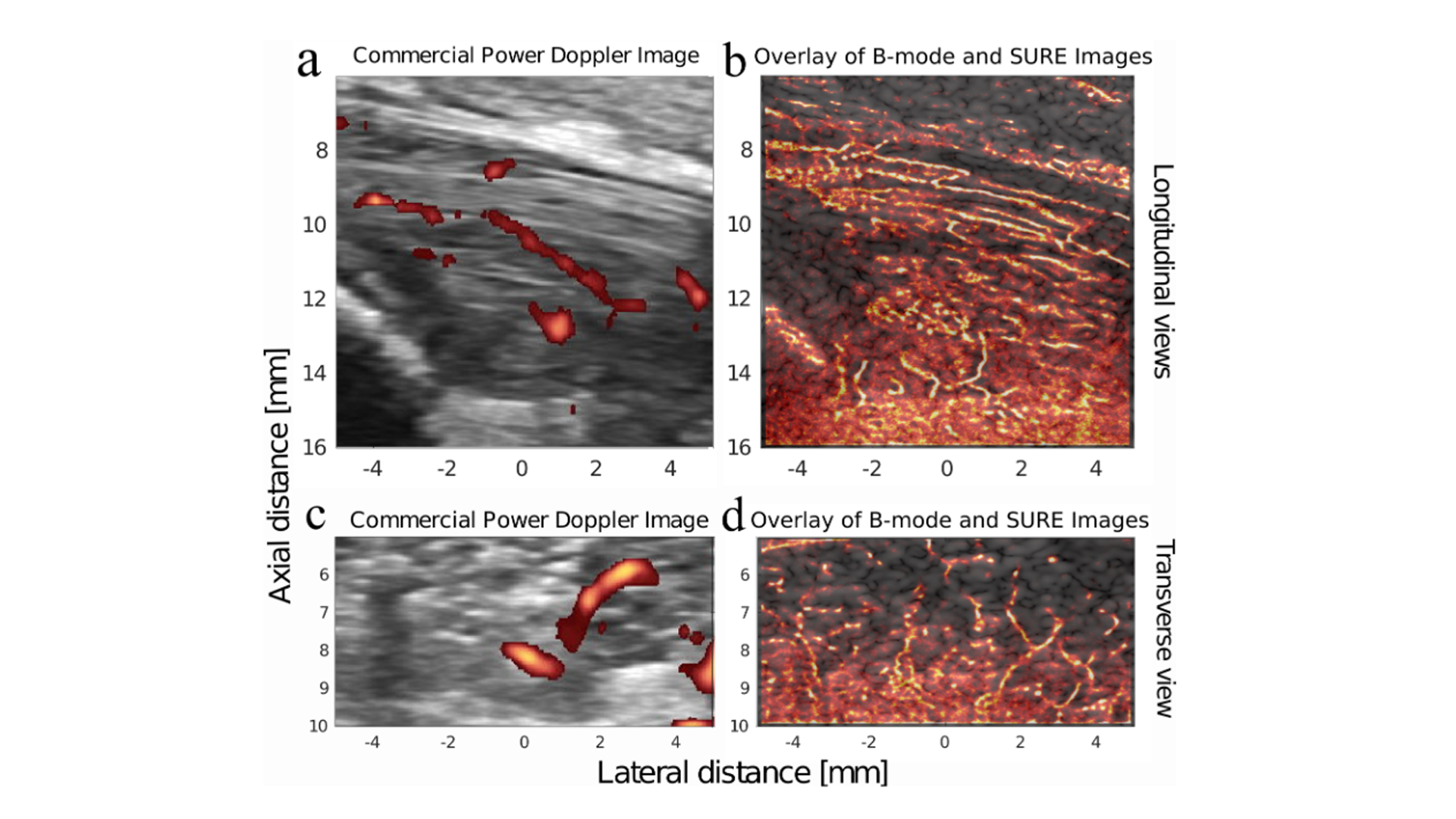 How can we reliably measure slow blood flow in a tendon