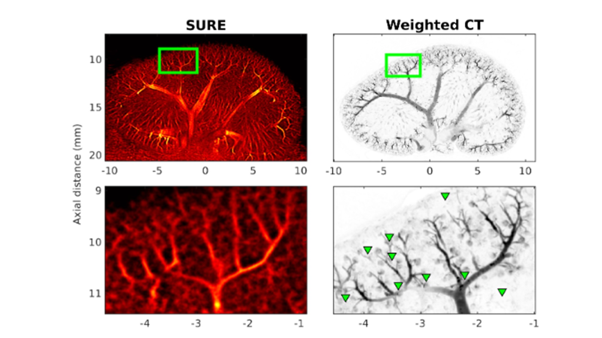 Cross-Modality Registration of 2D Super-Resolution Ultrasound to 3D ...