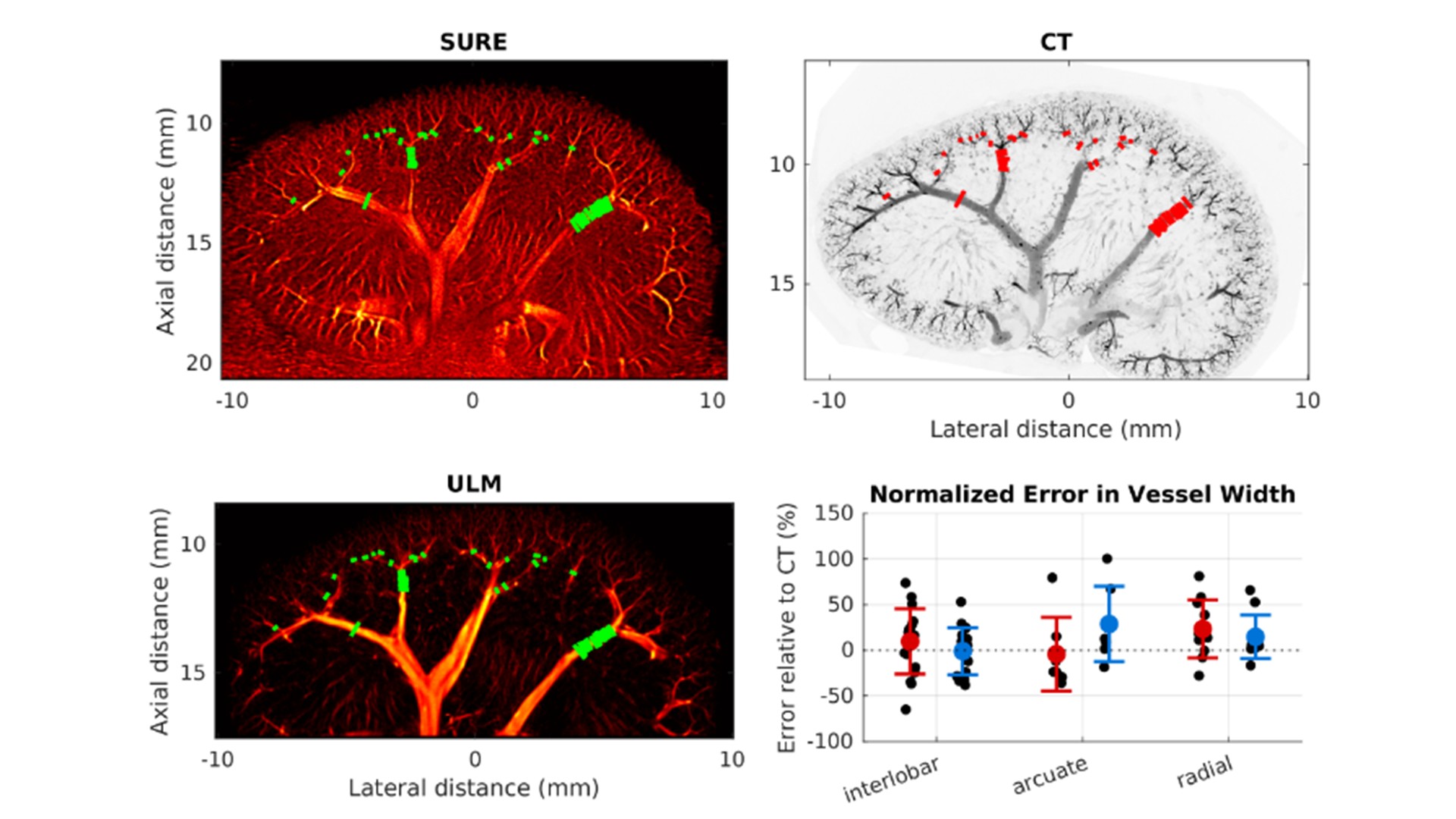 Validation of Vessel Width in Super-Resolution Ultrasound Imaging Using ...