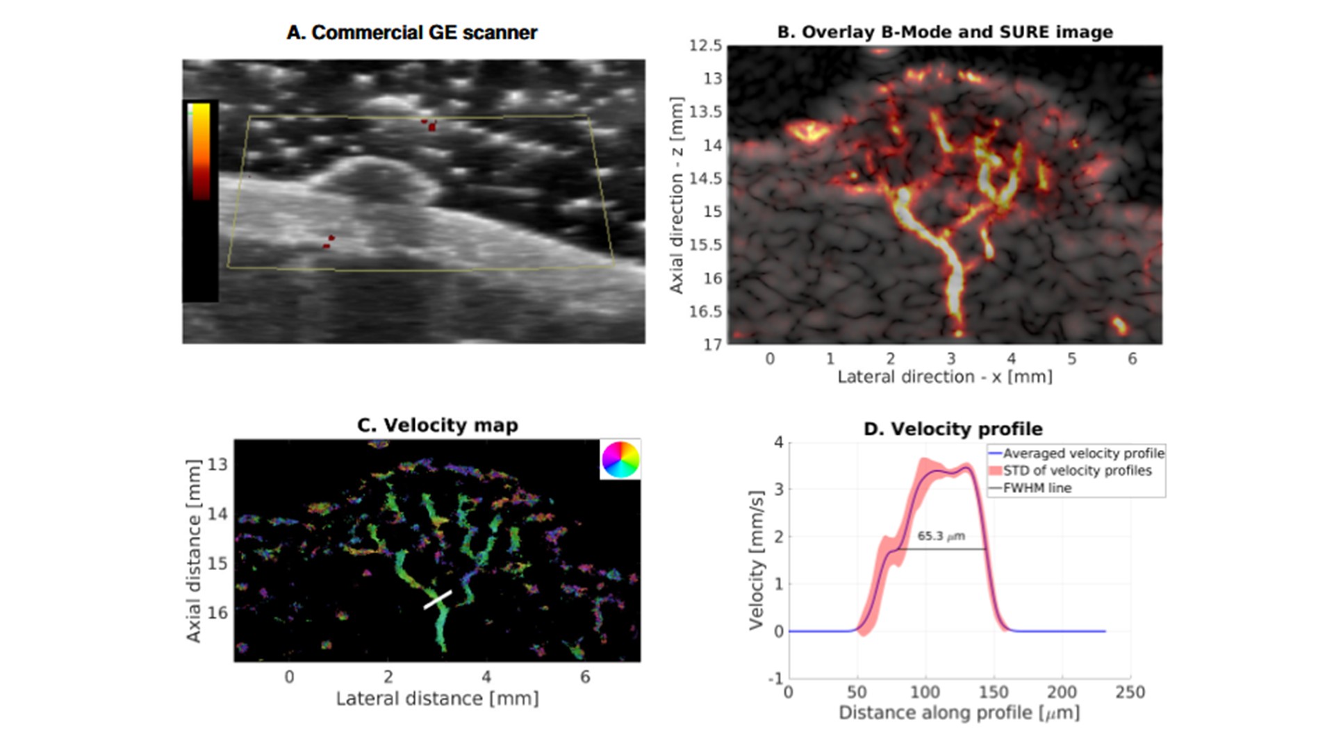 Human Mole Contrast-Free Microvascular Imaging using Erythrocytes